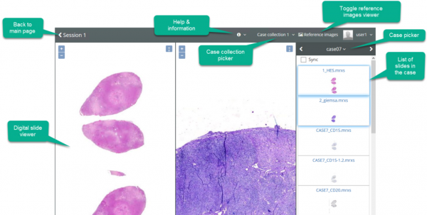 case_collection_explorer [Pathotrainer]